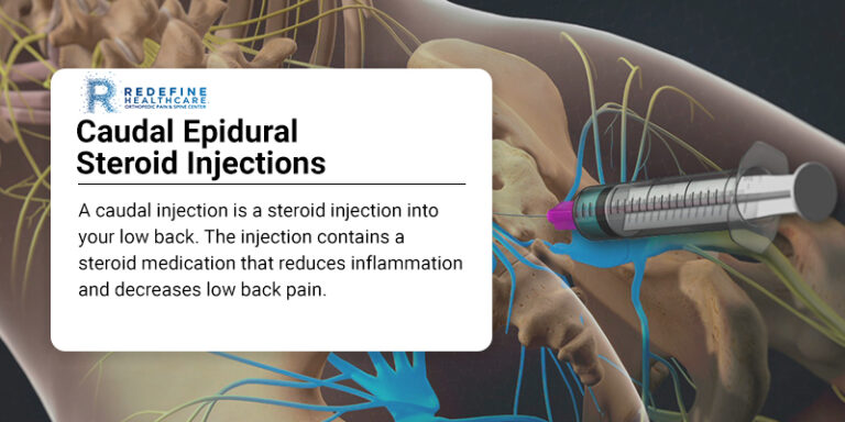 Caudal Epidural Steroid Injections in New Jersey | Redefine Healthcare