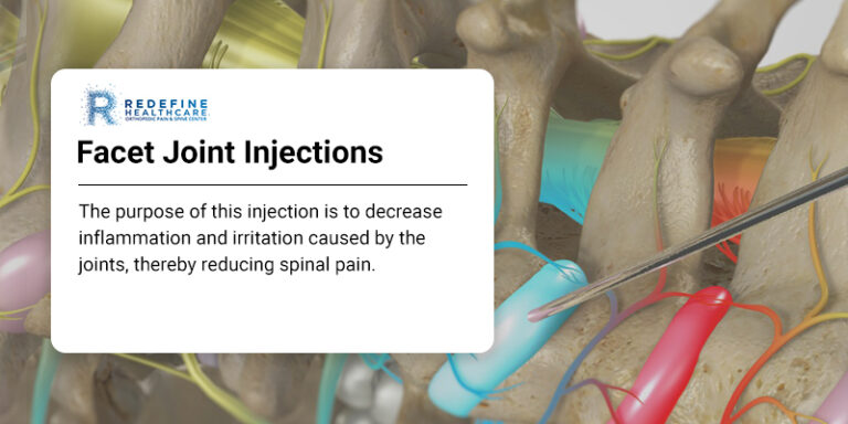 Facet Joint Injections - NJ's Top Orthopedic Spine & Pain Management Center