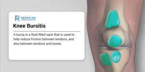Knee Bursitis - NJ's Top Orthopedic Spine & Pain Management Center
