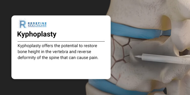 Kyphoplasty - NJ's Top Orthopedic Spine & Pain Management Center
