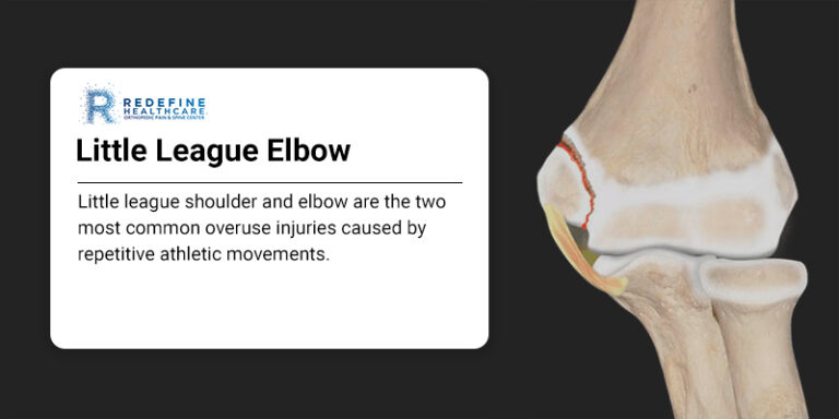Little League Shoulder and Elbow - NJ's Top Orthopedic Spine & Pain ...