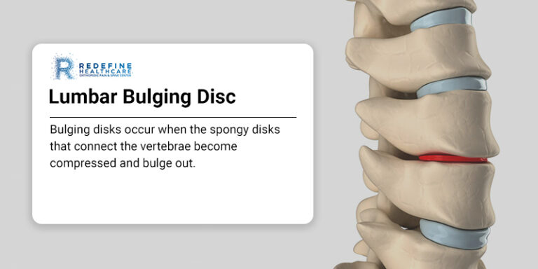 Lumbar Bulging Disc Treatment in NJ | Bulging Disc Specialists New Jersey