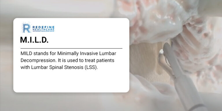 M.I.L.D. (Minimally Invasive Lumbar Decompression) - NJ's Top ...