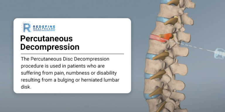 Percutaneous Decompression - NJ's Top Orthopedic Spine & Pain ...