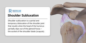 Shoulder Subluxation - NJ's Top Orthopedic Spine & Pain Management Center