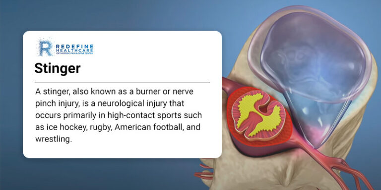 Stinger - NJ's Top Orthopedic Spine & Pain Management Center
