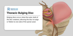 Thoracic Bulging Disc Treatment in NJ: Union, Edison, West Caldwell ...