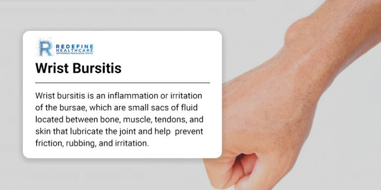 Wrist Bursitis - NJ's Top Orthopedic Spine & Pain Management Center