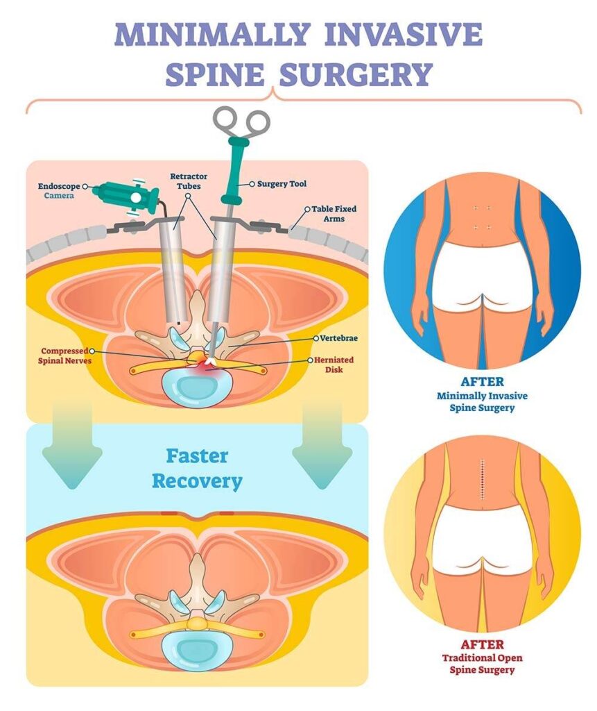 Spine Surgery Treatment Specialists in New Jersey - NJ's Top Orthopedic ...